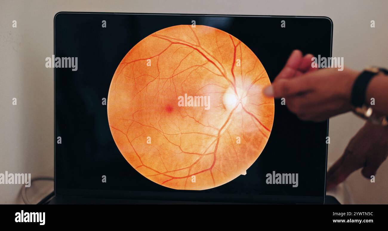 Hands, eye scan and screen in optometry for doctor, consultation and ...