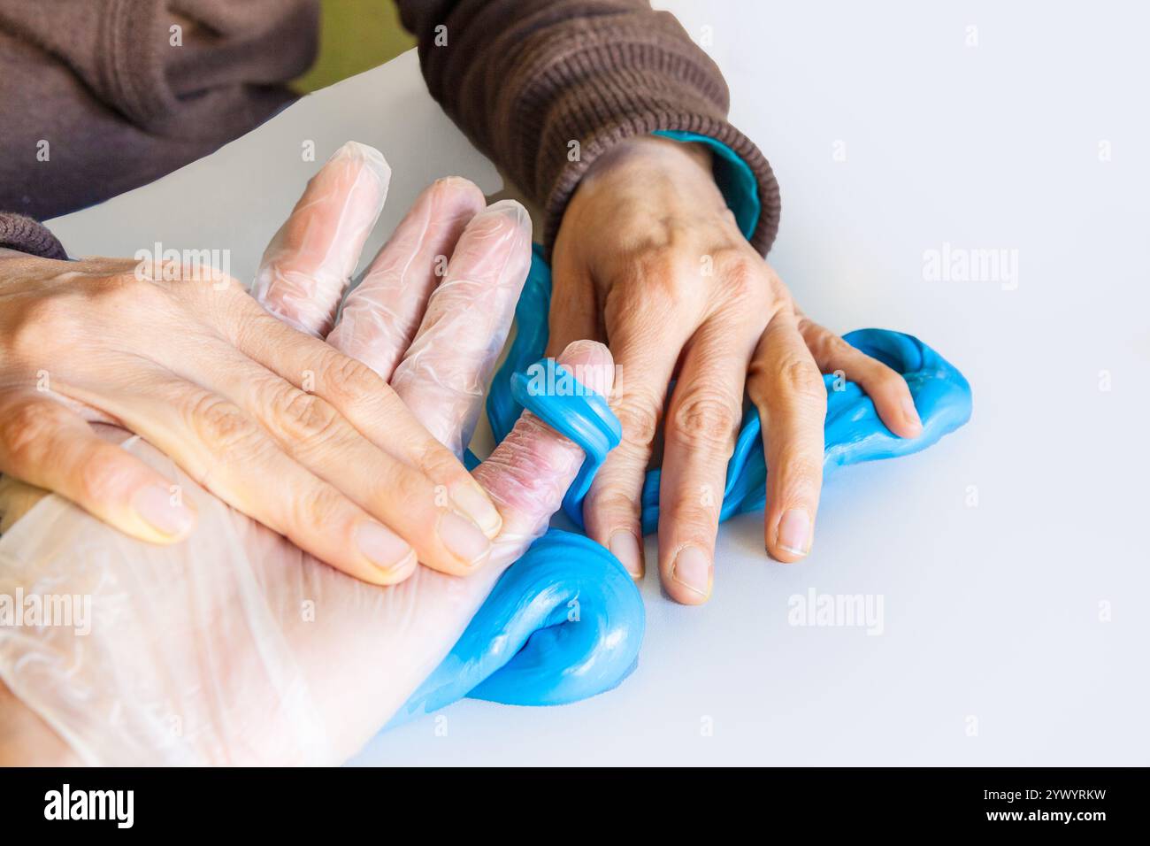 hand physiotherapy to recover a broken finder Stock Photo - Alamy