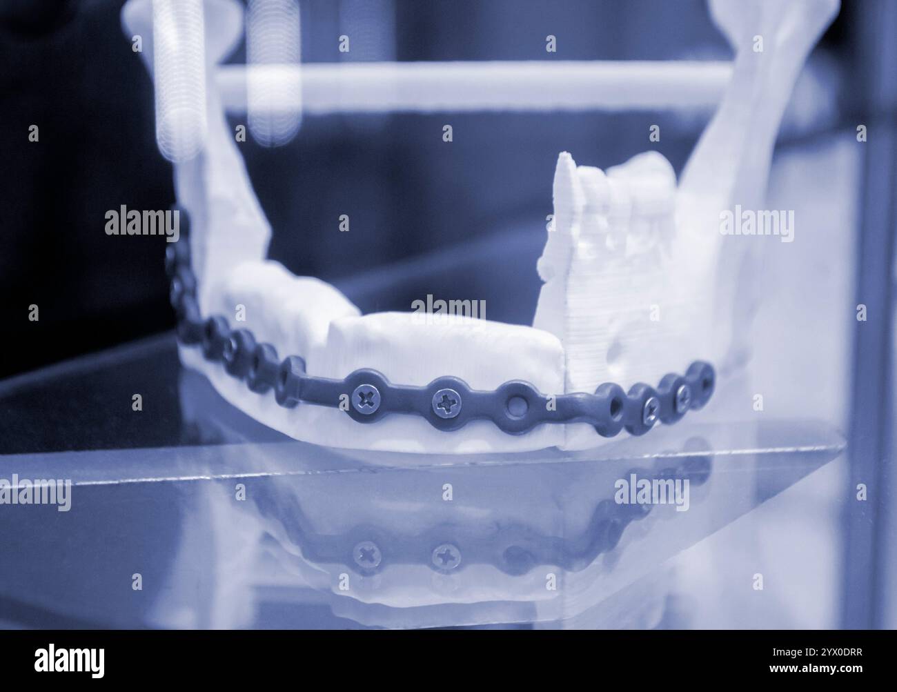 Individual endoprostheses hi-res stock photography and images - Alamy