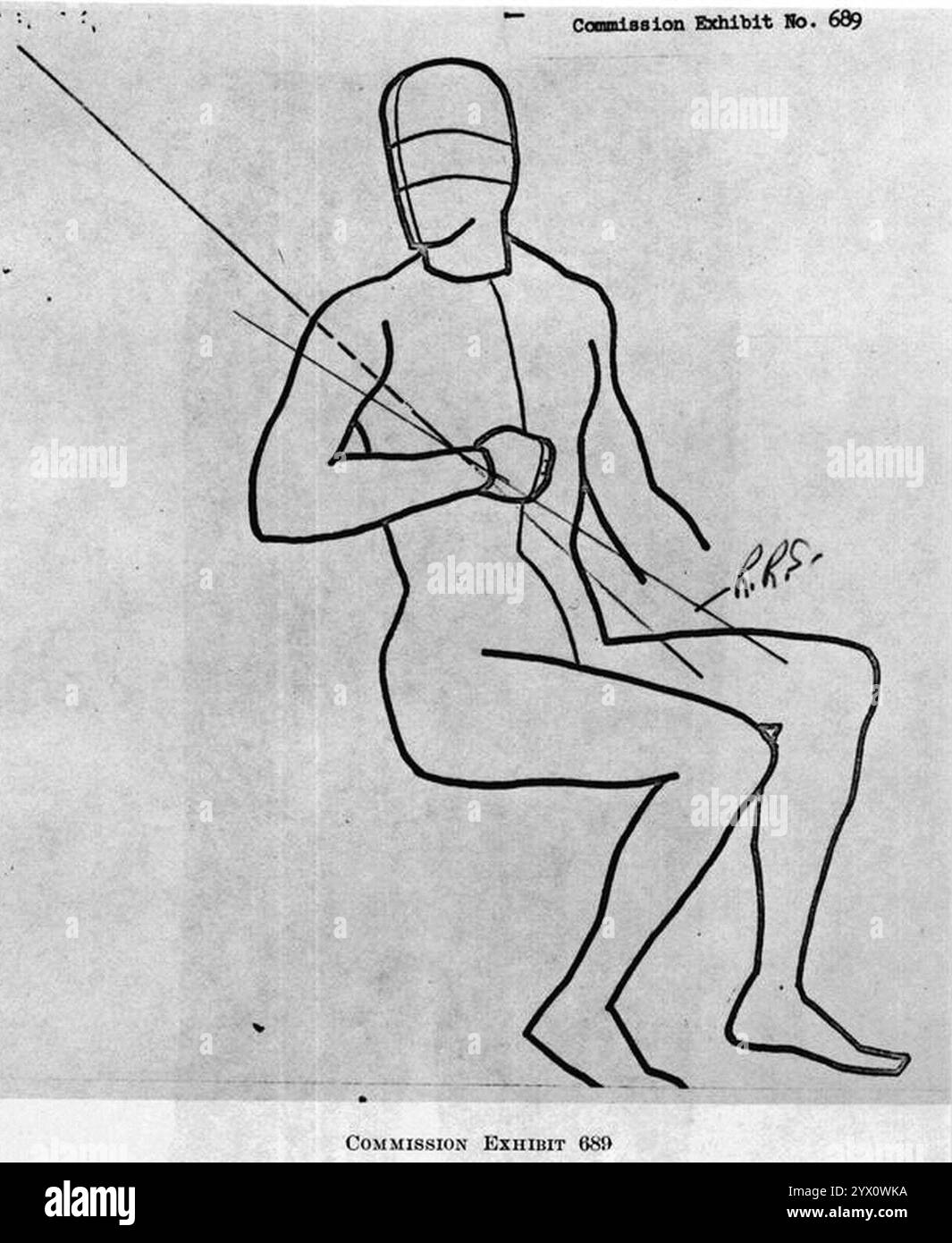 Connally chest wounds. Drawing by Dr Shaw during WC hearings, CE689 ...