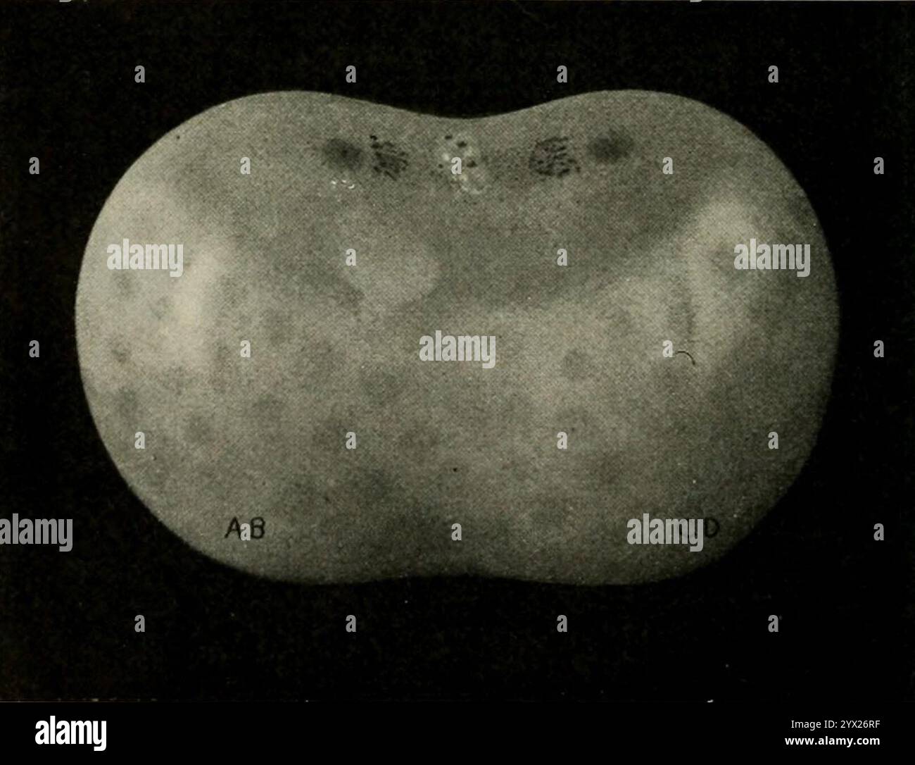 Crepidula First cleavage. Separation of chromosomes Stock Photo - Alamy