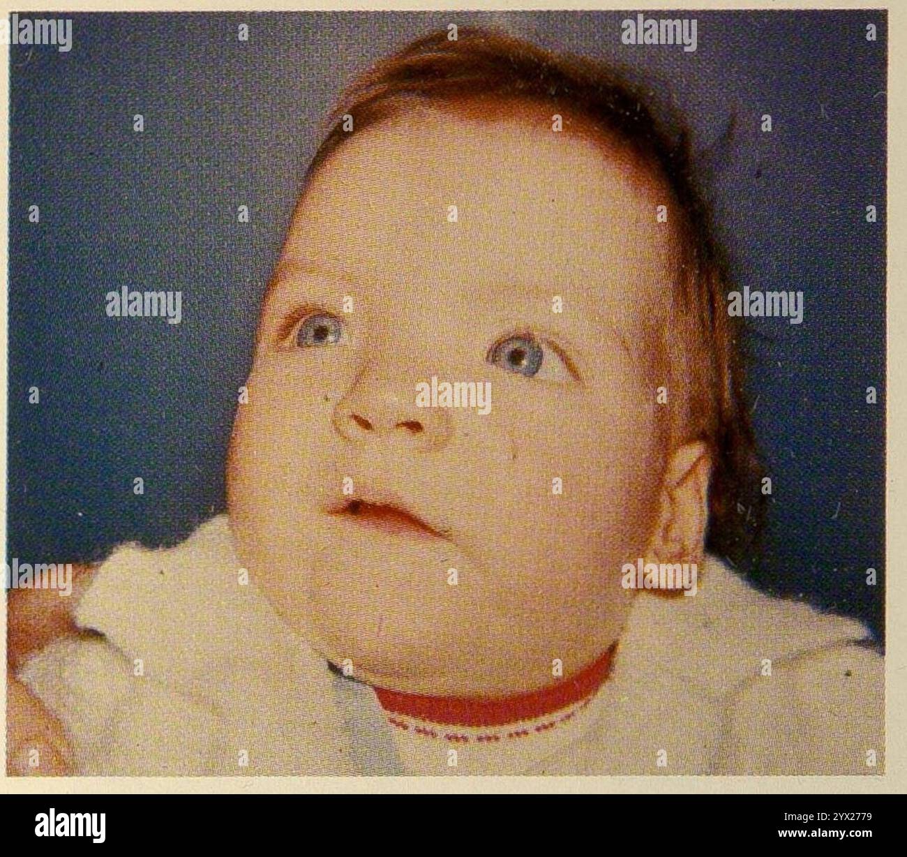 Cri du Chat 1 Stock Photo - Alamy