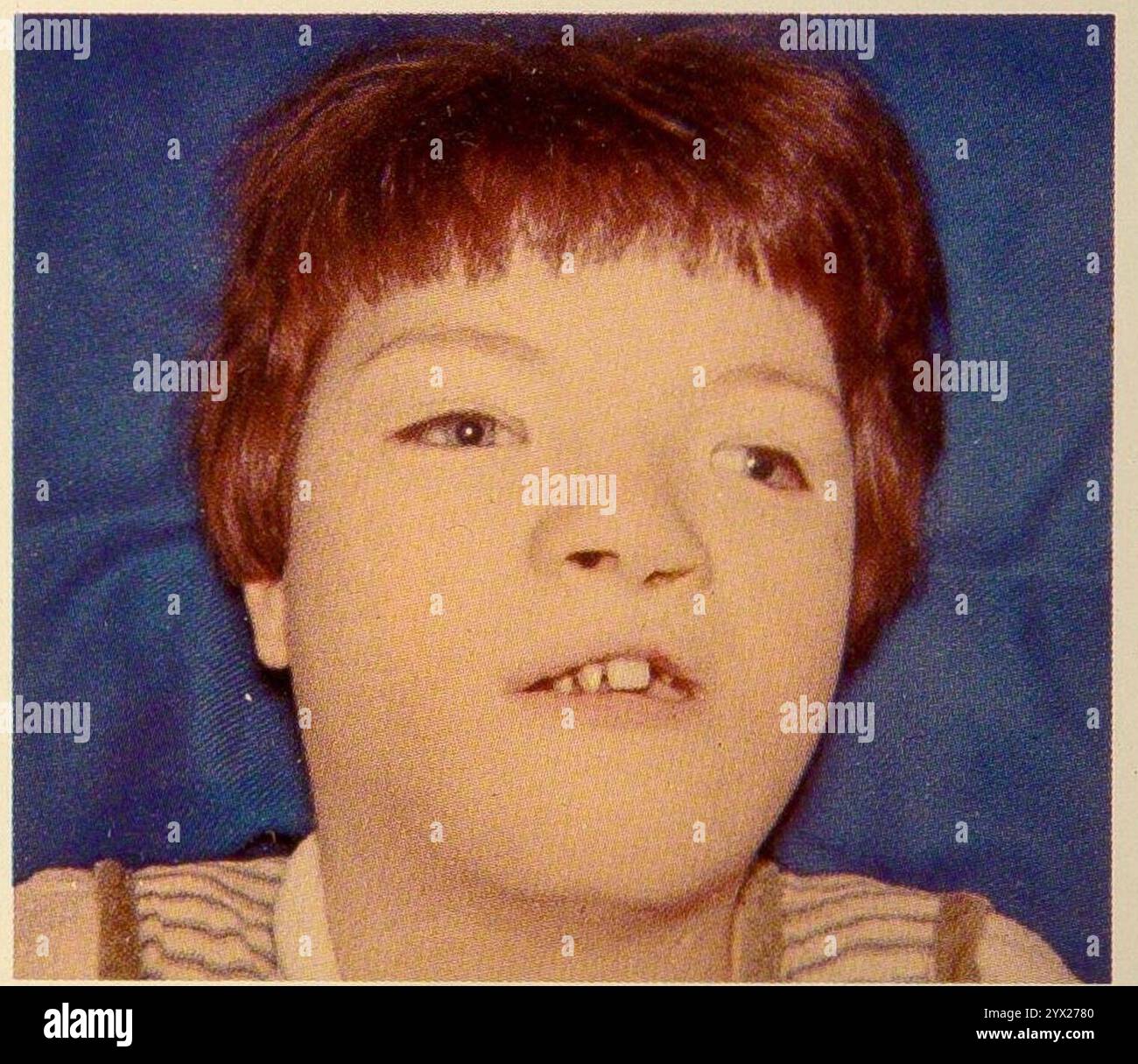 Cri du Chat 5 Stock Photo - Alamy