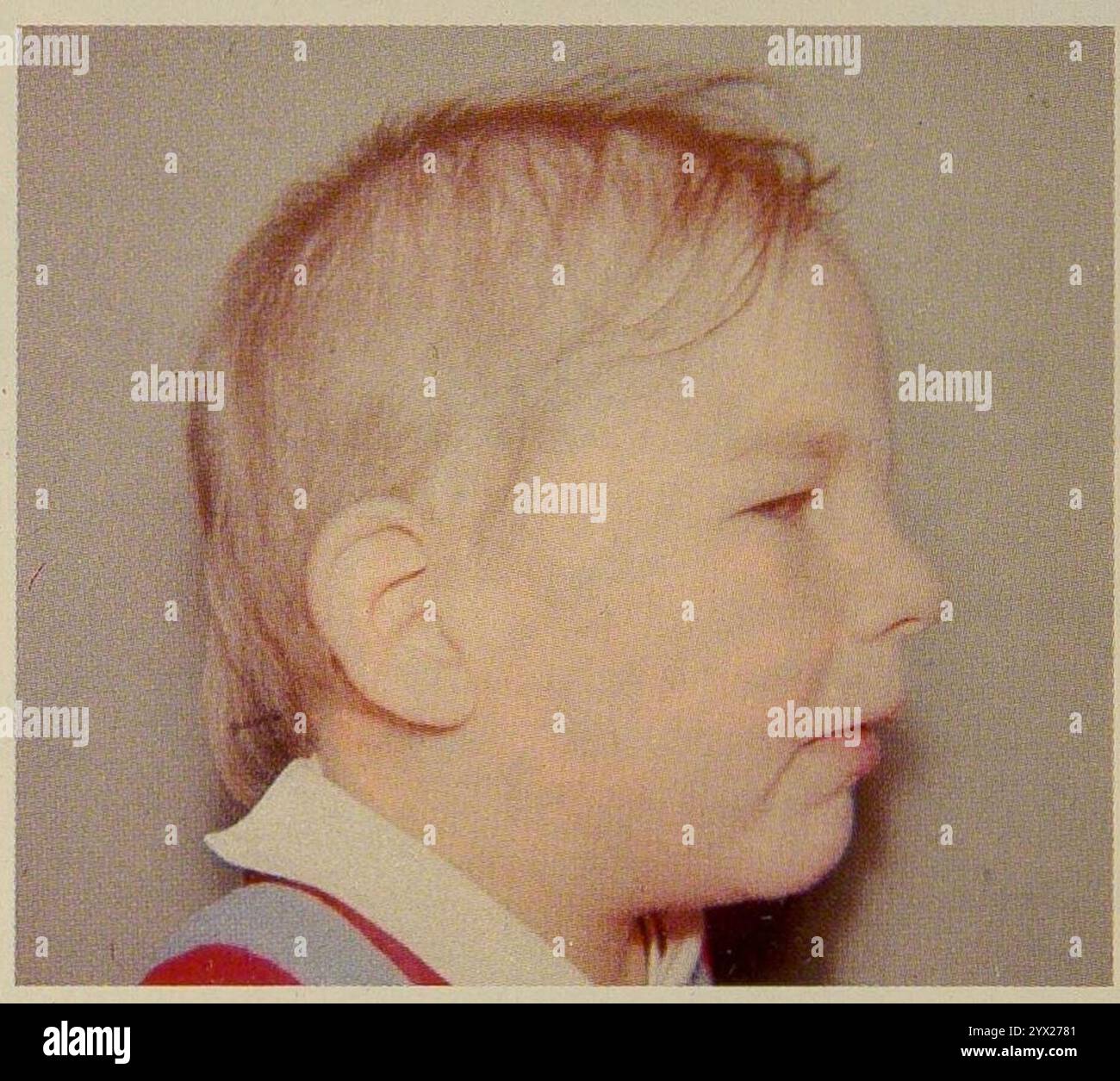 Cri du Chat 4 Stock Photo - Alamy