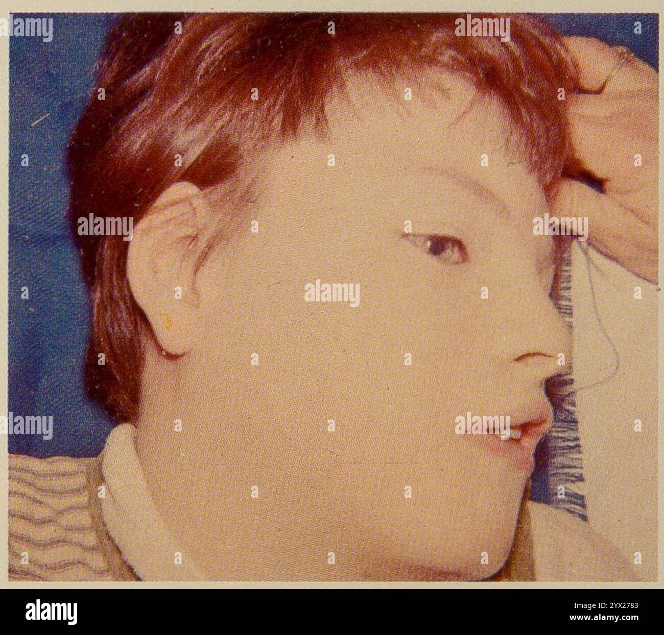 Cri du Chat 6 Stock Photo - Alamy