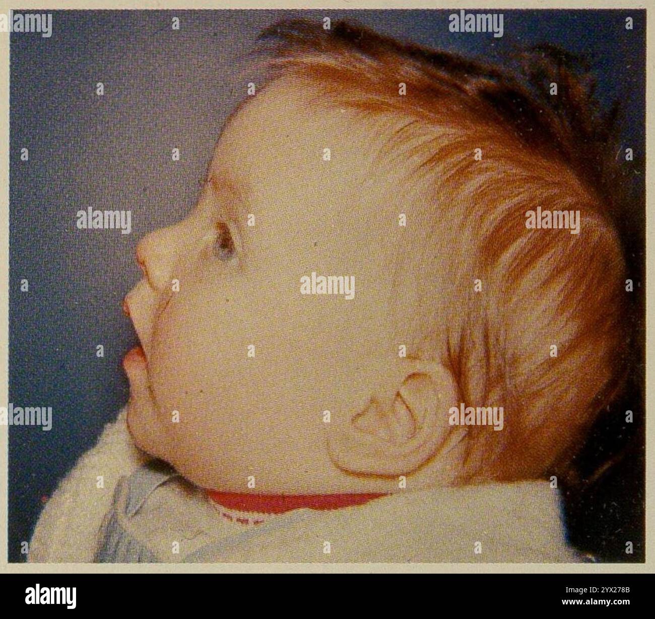 Cri du chat hi-res stock photography and images - Alamy