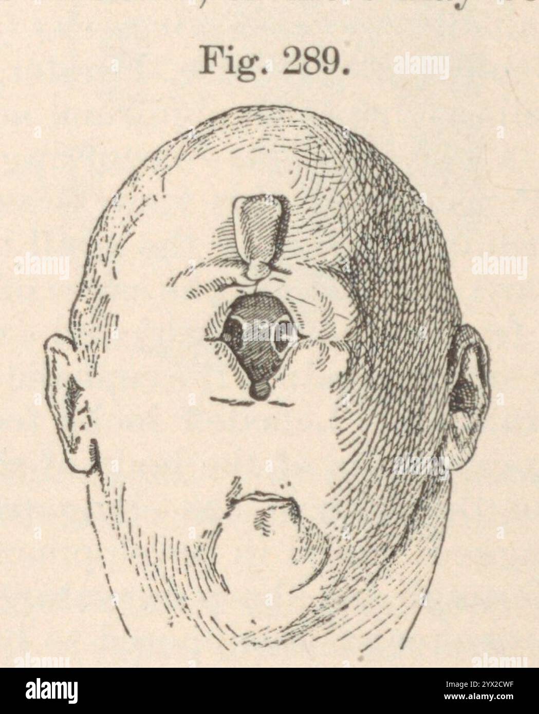 Cyclopia hi-res stock photography and images - Alamy