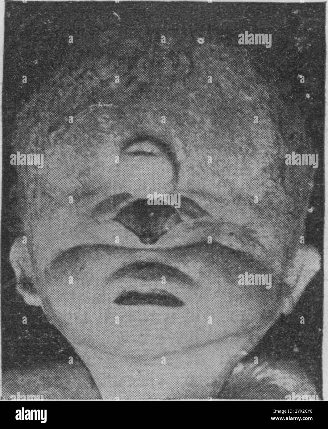 Cyclopia hi-res stock photography and images - Alamy