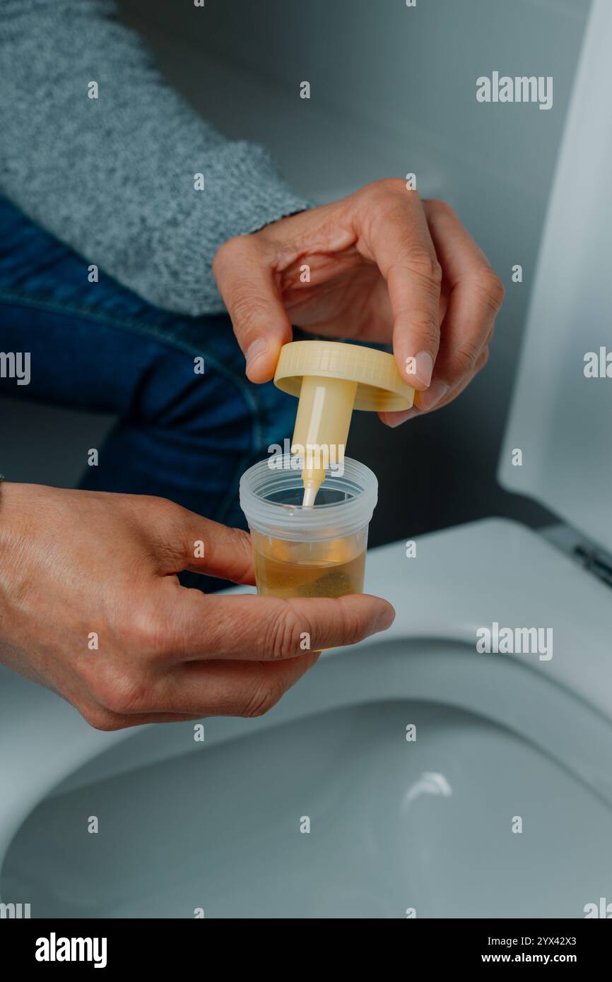 a caucasian man collects a urine sample in a sterile plastic container ...
