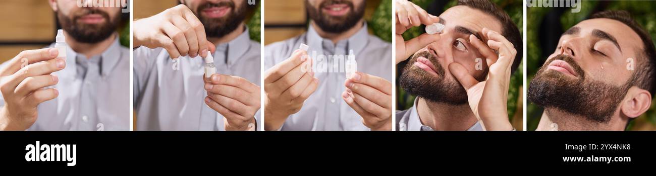 Young man handling eye drops, opening bottle, applying to eye for ...