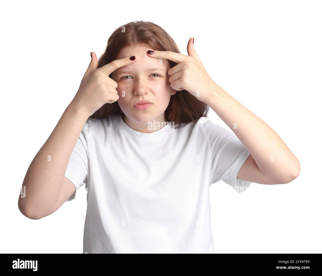 Teenage girl popping pimple on her face against white background. Acne ...