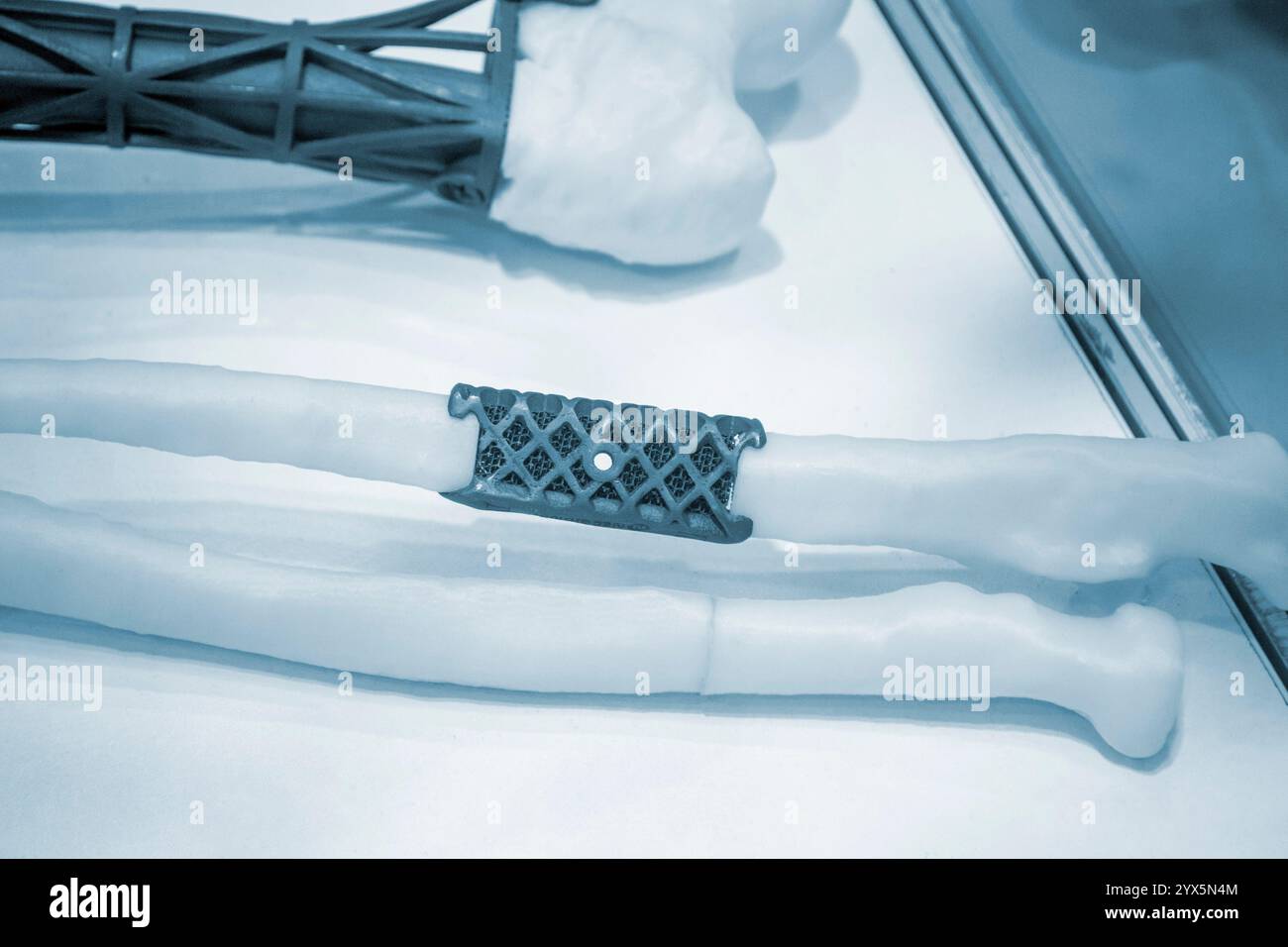 Implants and prostheses printed on 3D printer from biocompatible ...