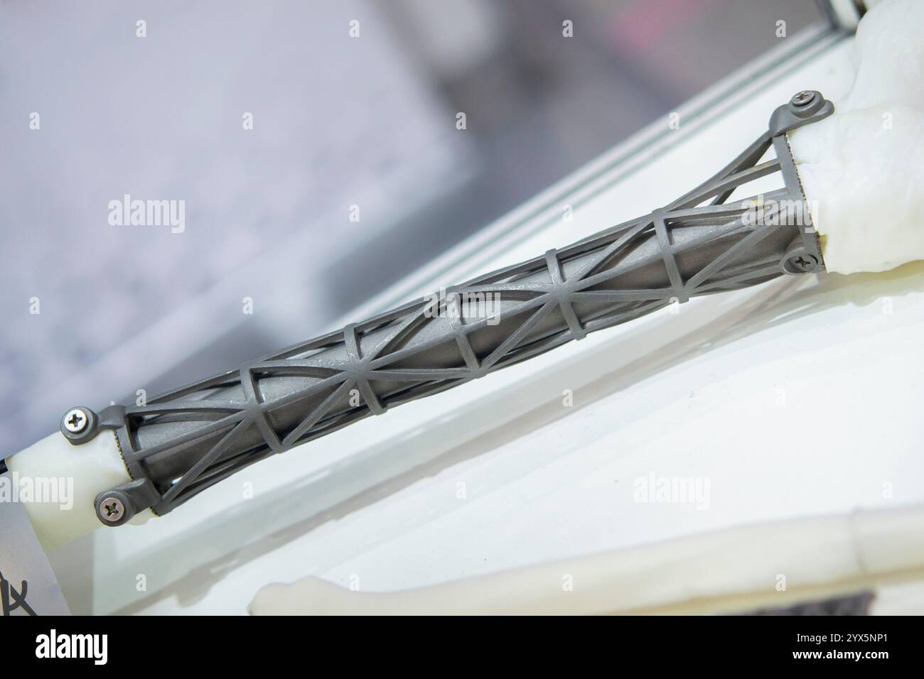 Individual endoprostheses hi-res stock photography and images - Alamy