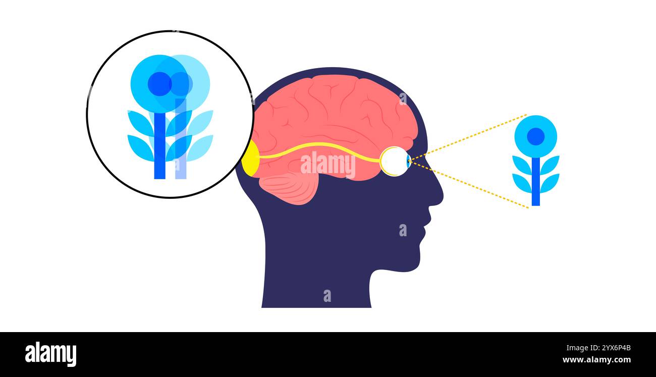 Double vision (diplopia), illustration Stock Photo - Alamy