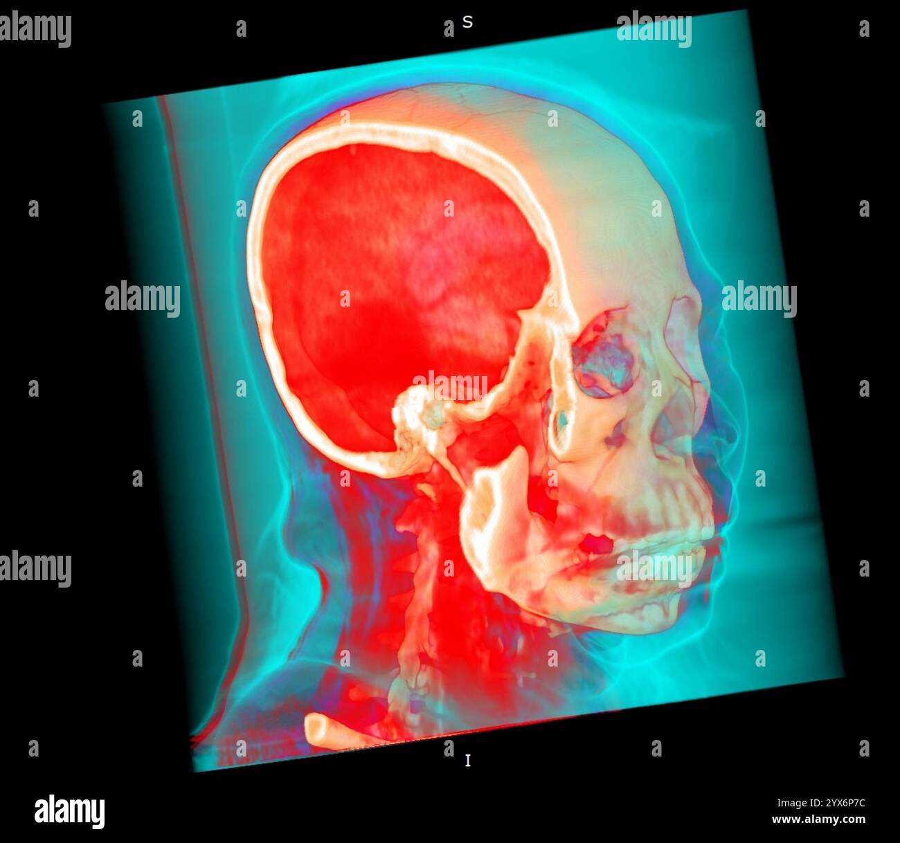 Human skull coloured 3d hi-res stock photography and images - Alamy