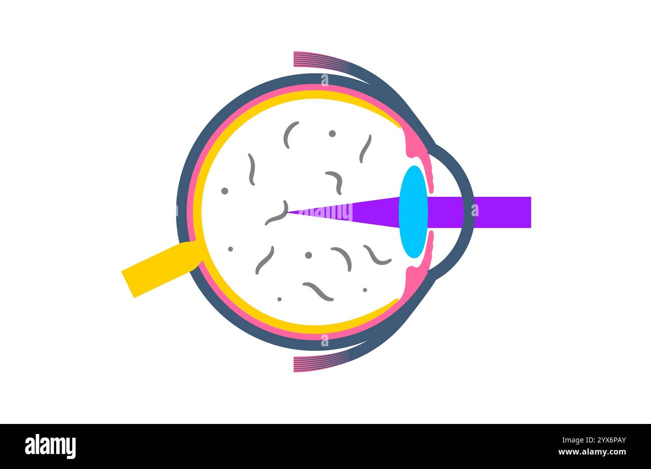 Vision treatment Cut Out Stock Images & Pictures - Alamy