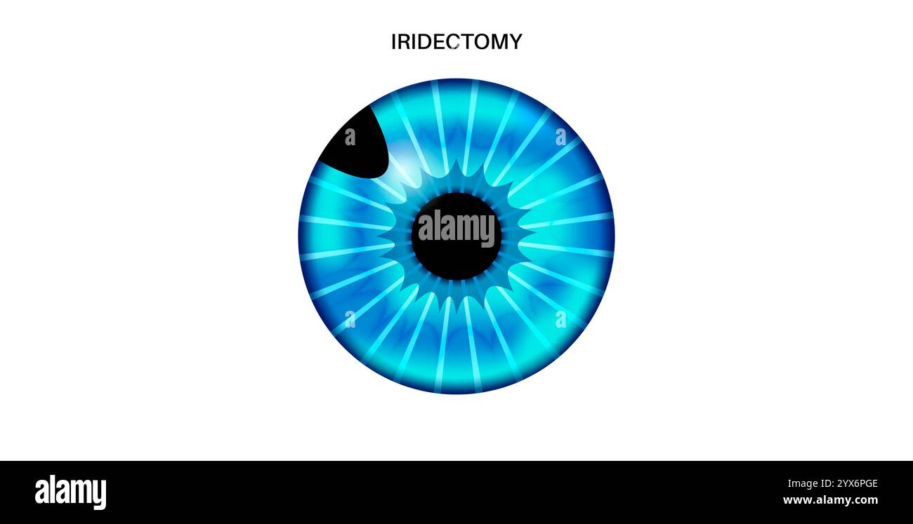 Trabecular meshwork hi-res stock photography and images - Alamy