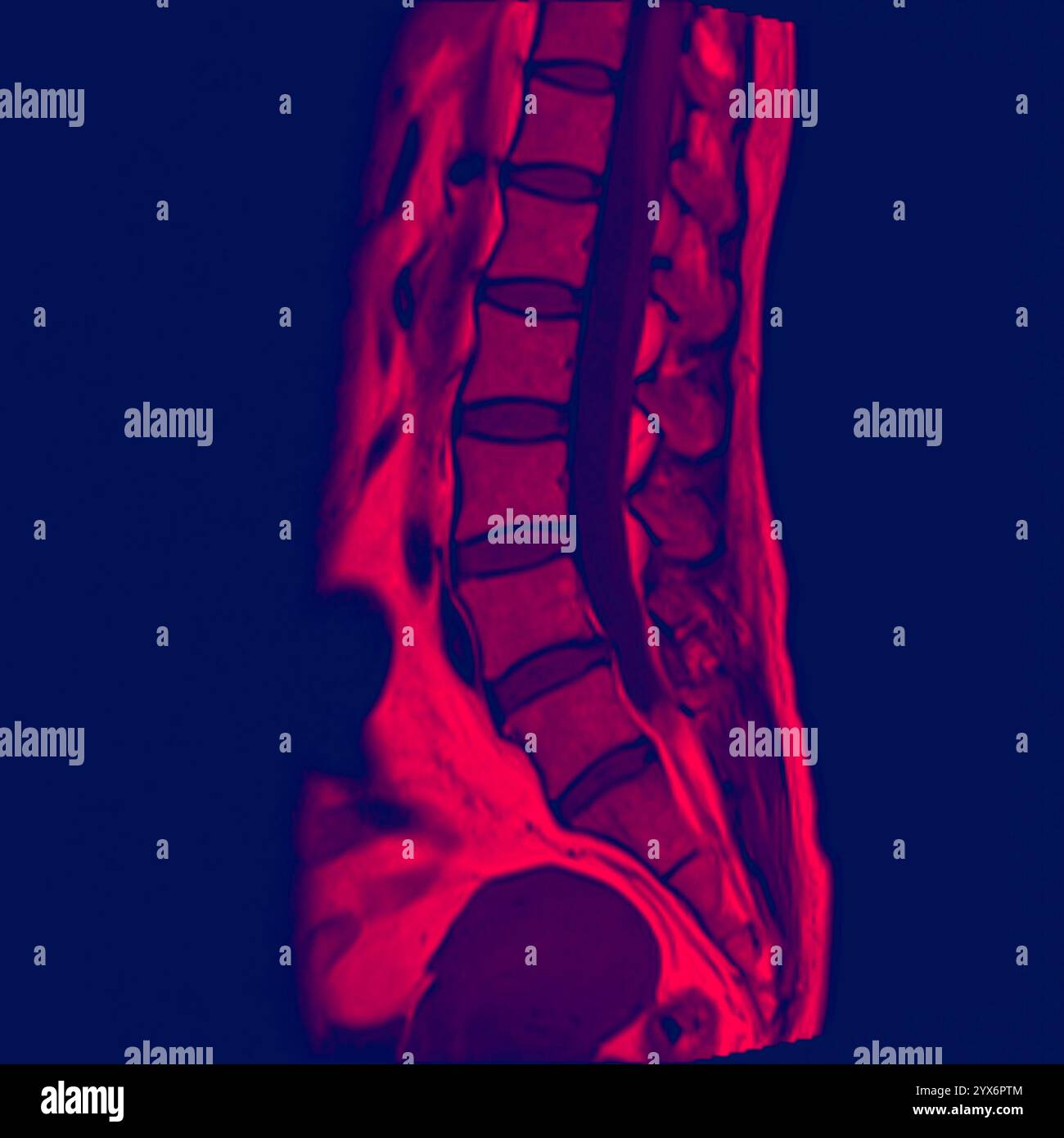 Sagittal coloured magnetic resonance imaging (MRI) scan of a healthy ...