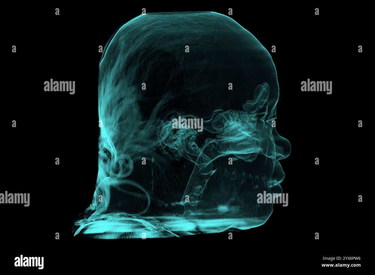 Coloured 3D computed tomography (CT) scan of a head showing the healthy upper airways and ...