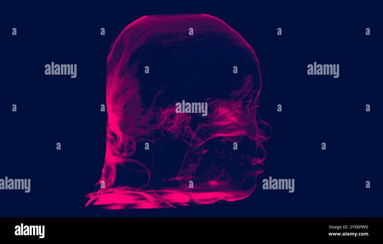 Coloured 3D computed tomography (CT) scan of a head showing the healthy ...