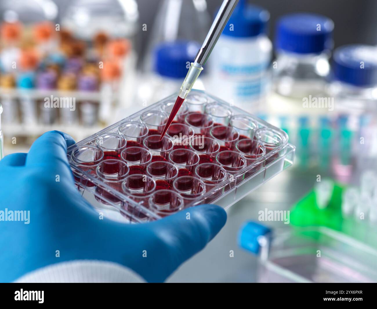 Blood cultures hi-res stock photography and images - Alamy