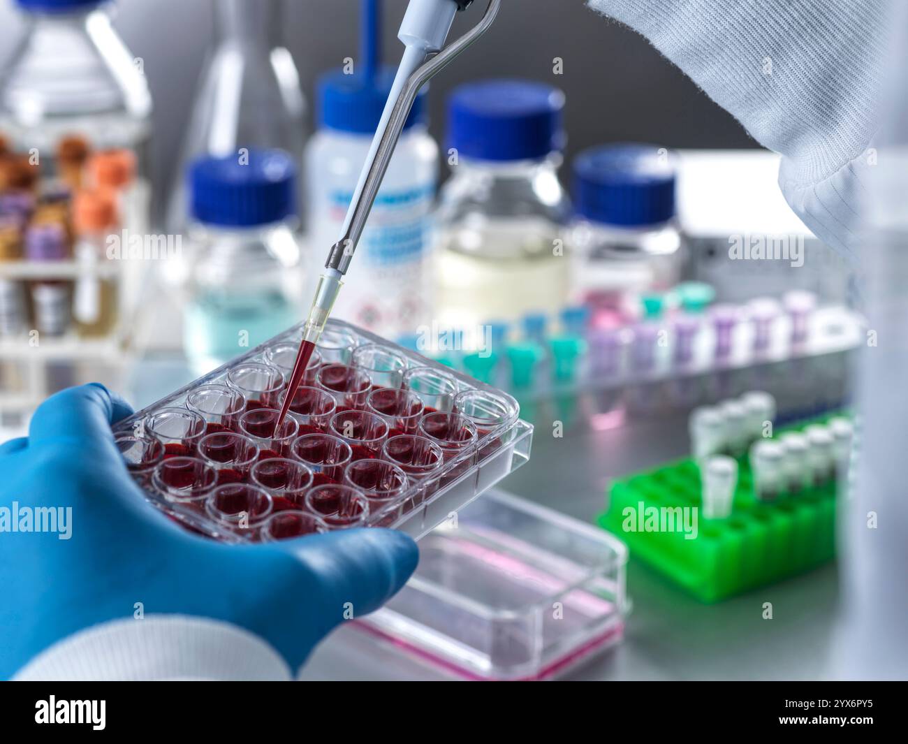 Scientist pipetting a blood sample into a multiwell plate Stock Photo ...
