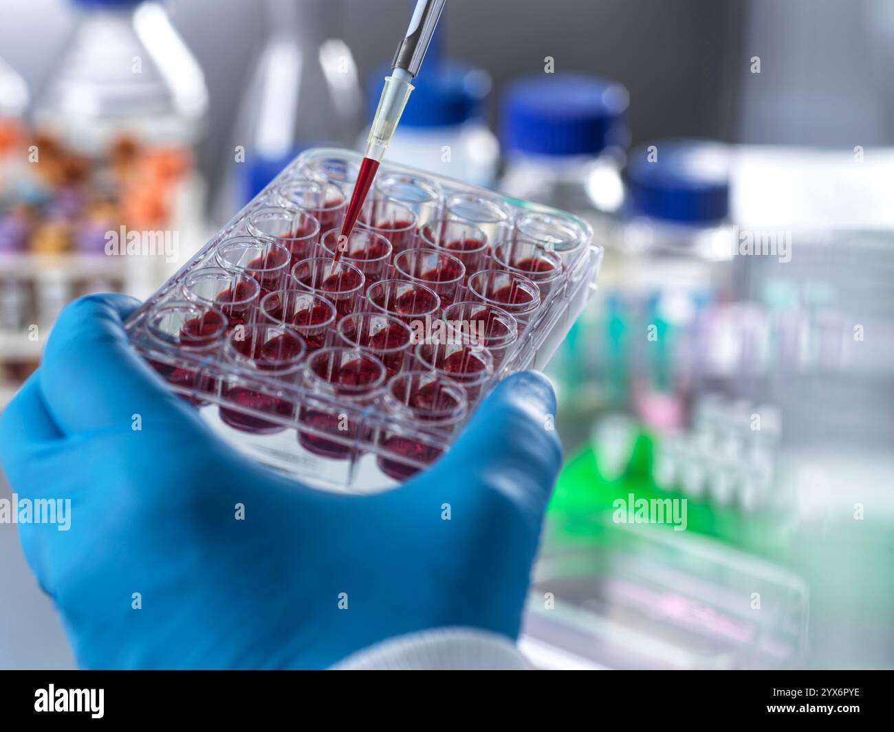 Scientist pipetting a blood sample into a multiwell plate Stock Photo ...