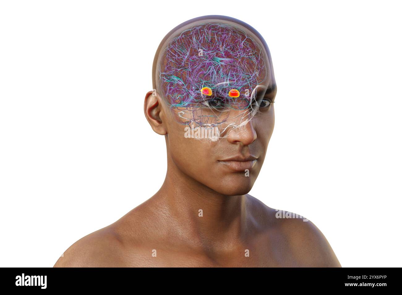 Computer illustration of the human brain with a highlighted amygdala ...