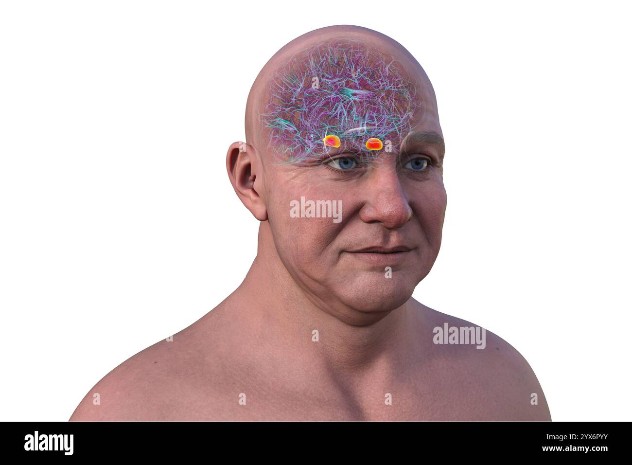 Computer illustration of the human brain with a highlighted amygdala ...