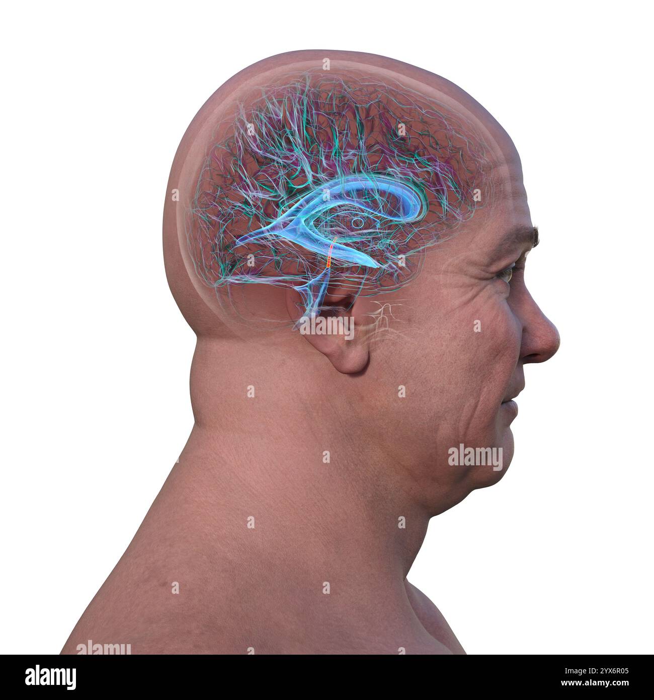 Computer Illustration Of The Human Brain With The Cerebral Aqueduct Highlighted In Orange And