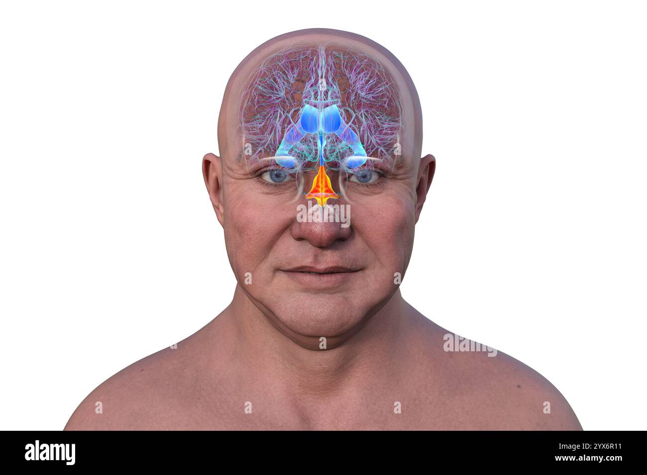 Computer illustration of the fourth brain ventricle (orange), a fluid ...