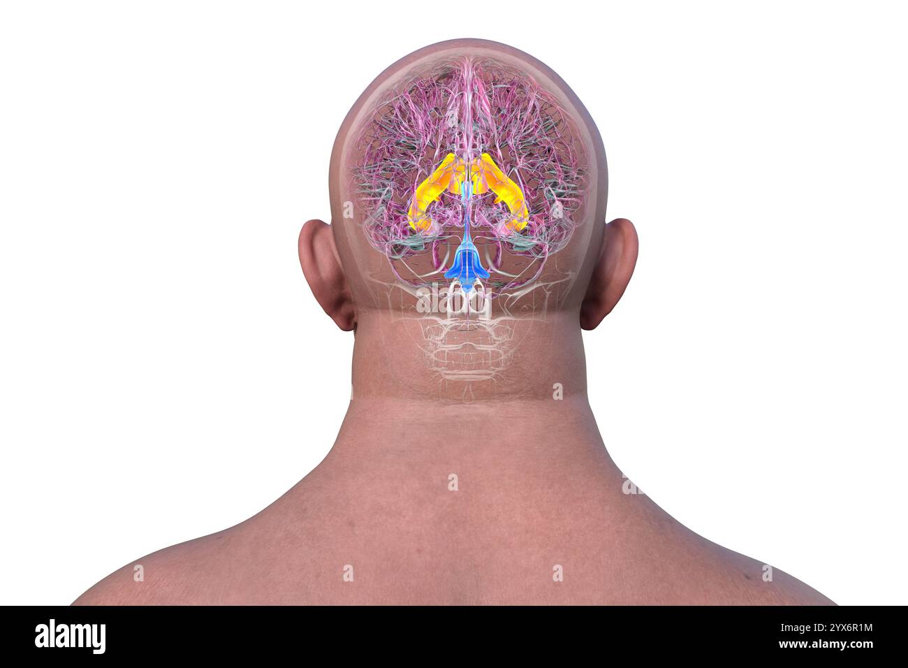 Computer illustration of the lateral brain ventricles, the largest ...