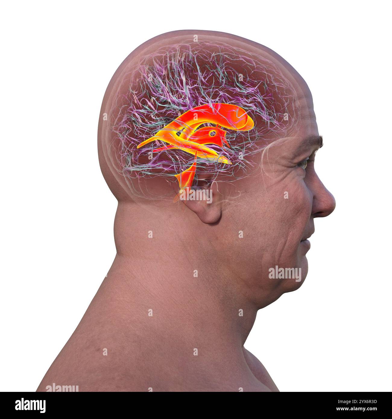 Ventricular system of the brain, computer illustration. The ventricles ...