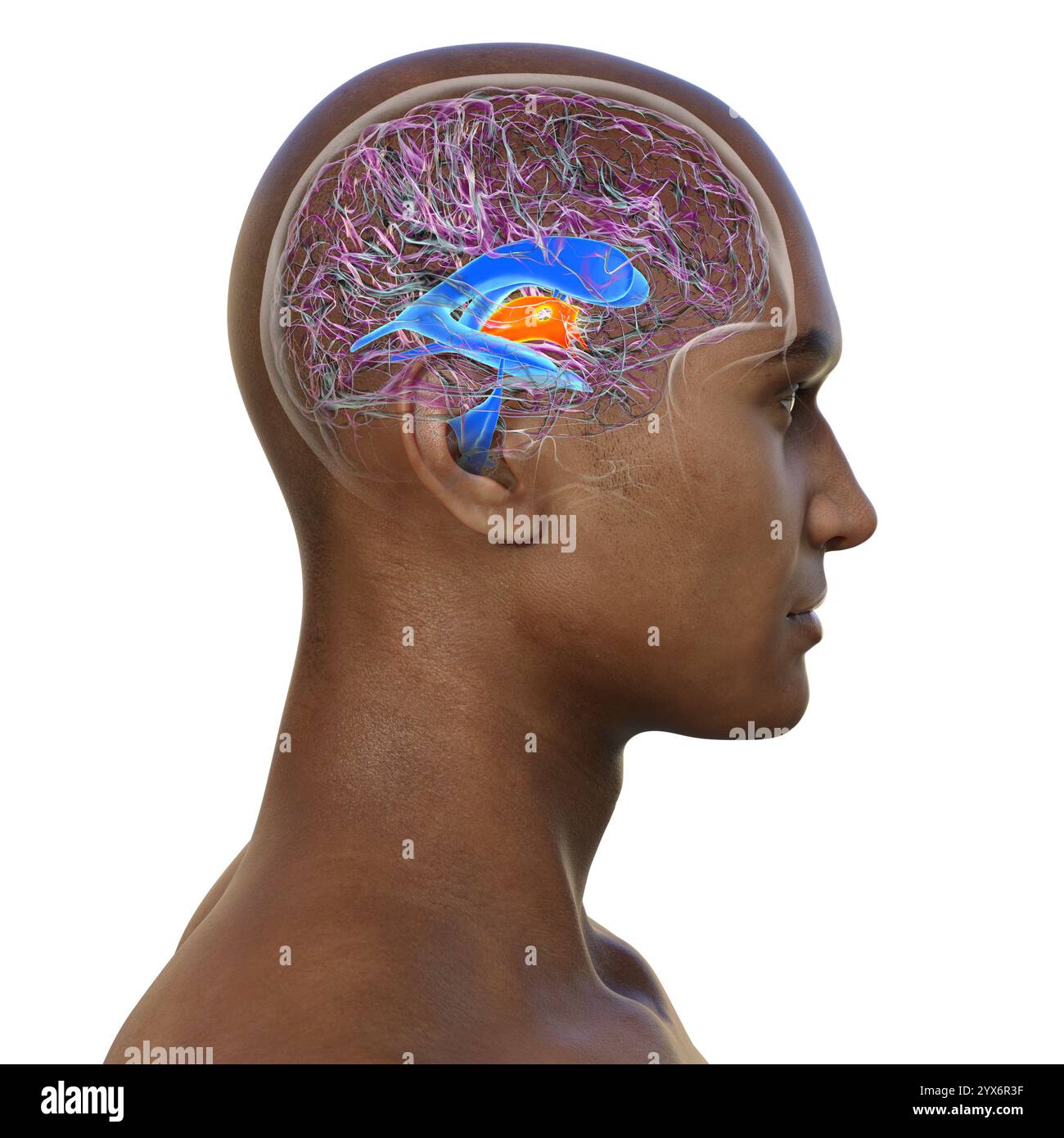 Computer illustration showing the third brain ventricle, a vital component of the brain's ...