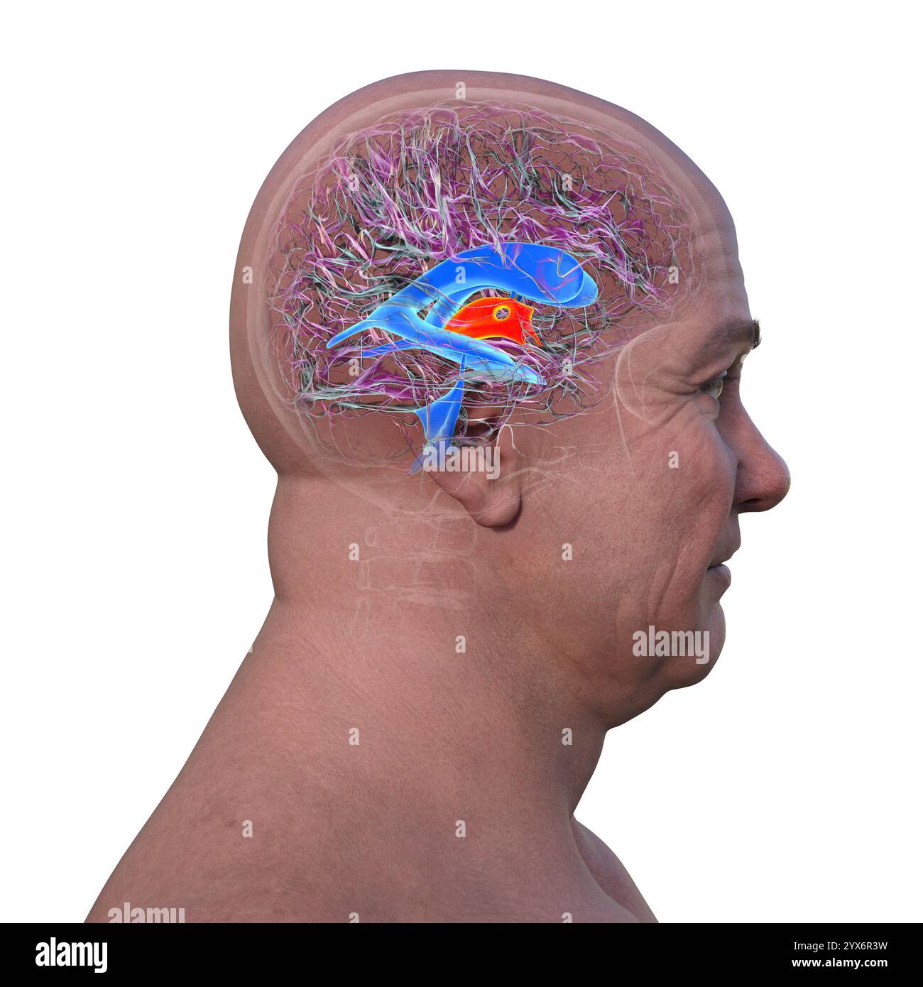 Computer illustration showing the third brain ventricle, a vital ...