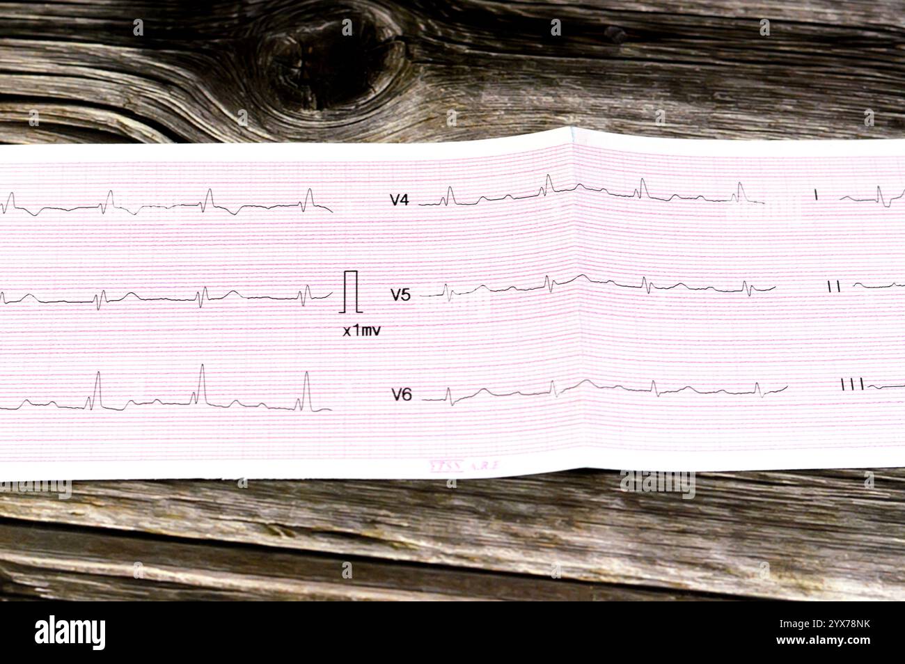 Cairo, Egypt, November 15 2024: ElectroCardioGraph ECG, a chart that ...