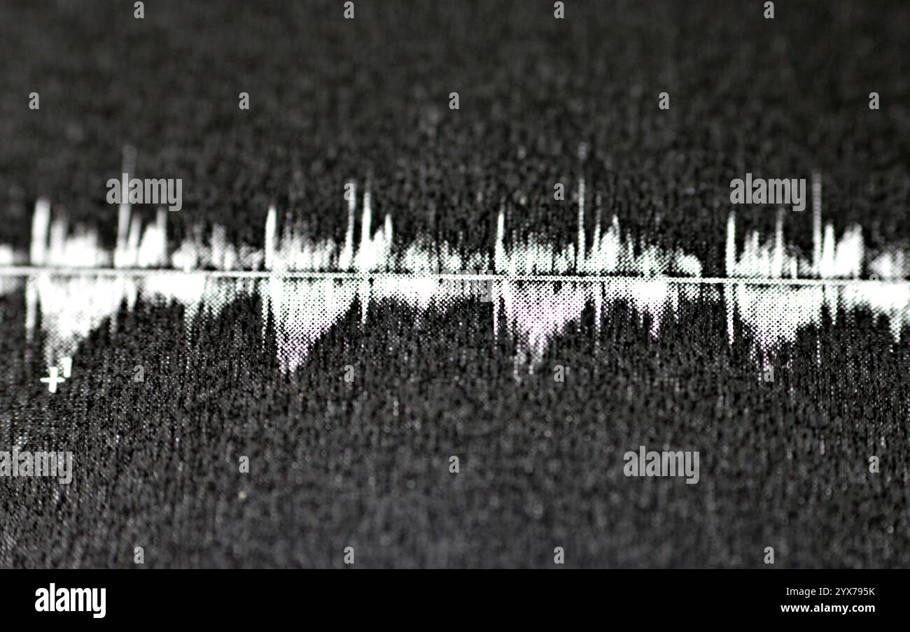 cardiac ultrasound, Echocardiography, a medical imaging using the ...
