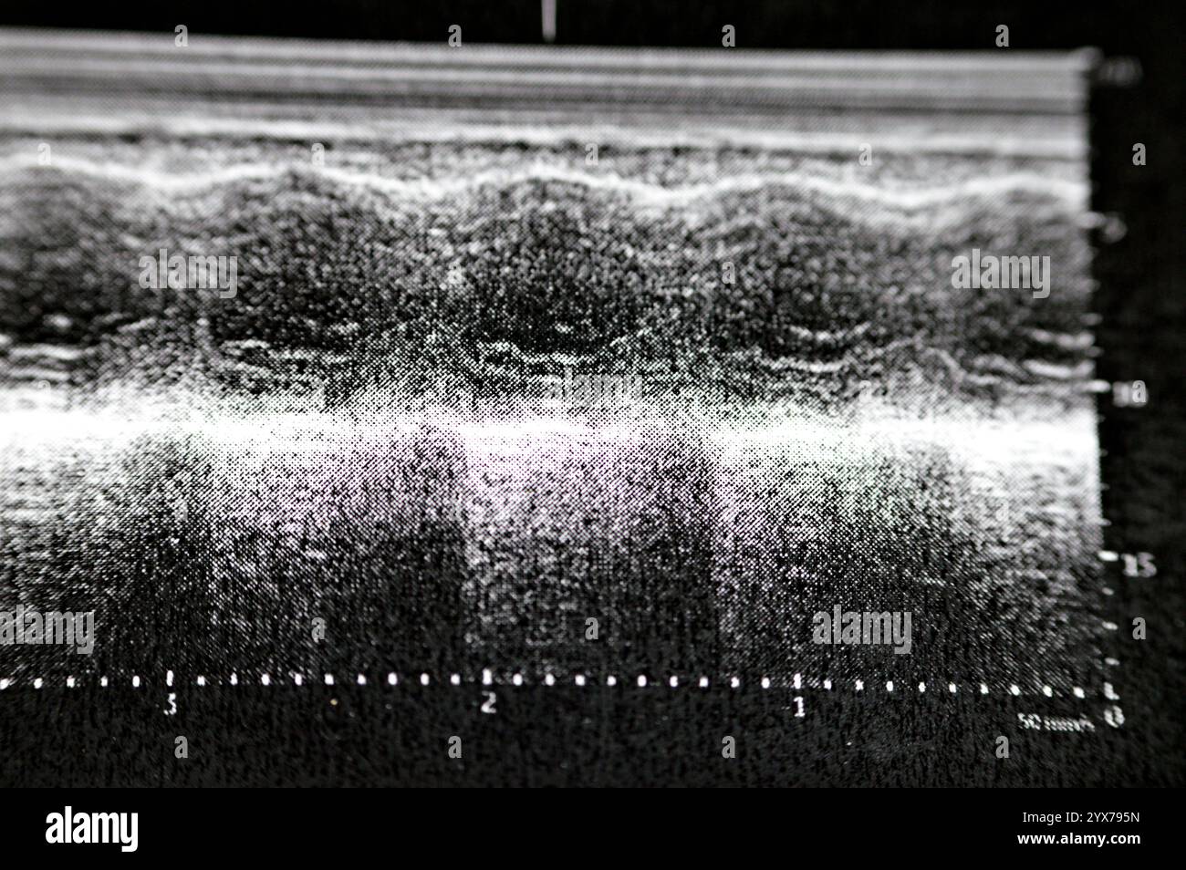 cardiac ultrasound, Echocardiography, a medical imaging using the ...
