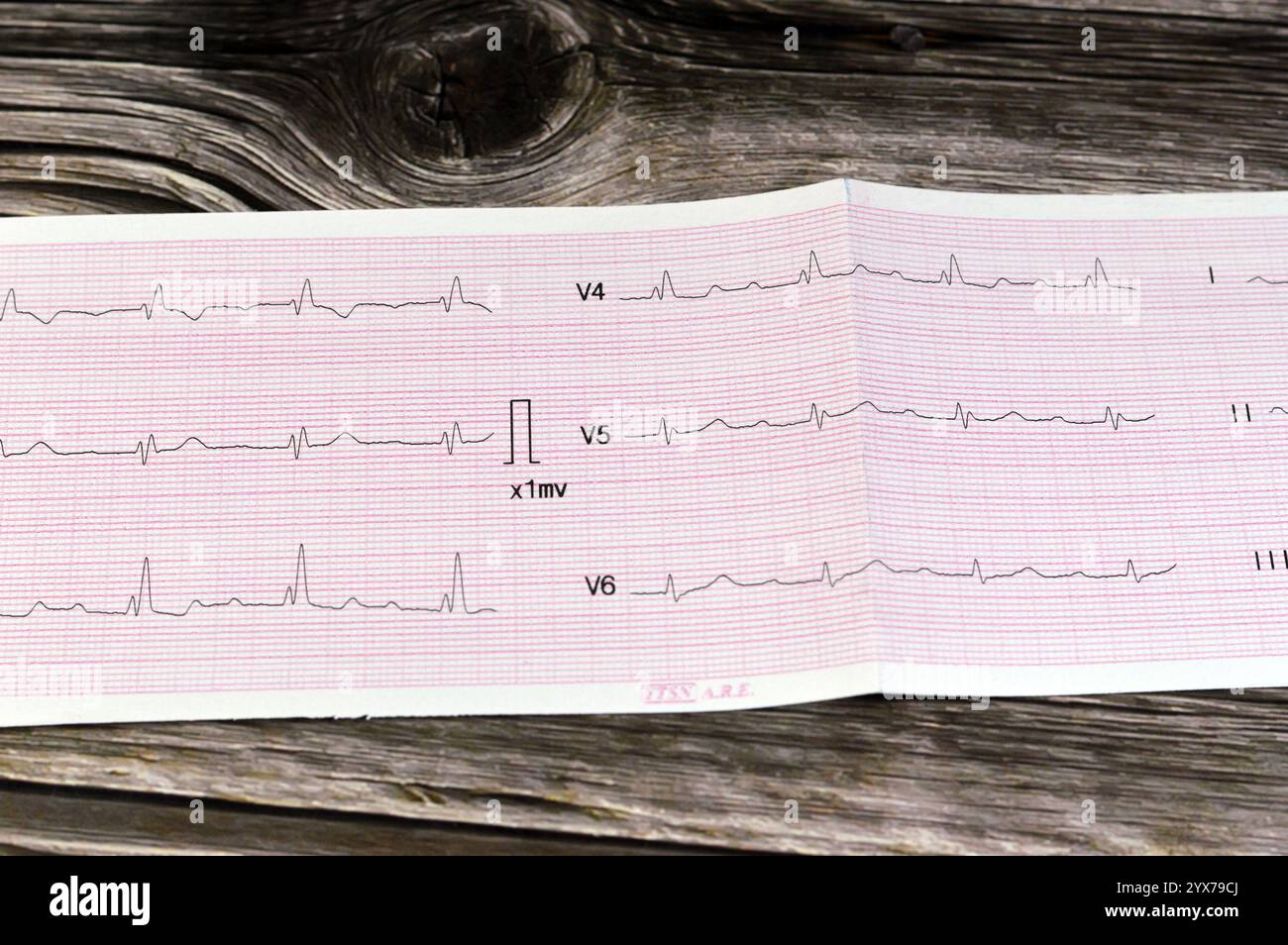 Cairo, Egypt, November 15 2024: ElectroCardioGraph ECG, a chart that ...