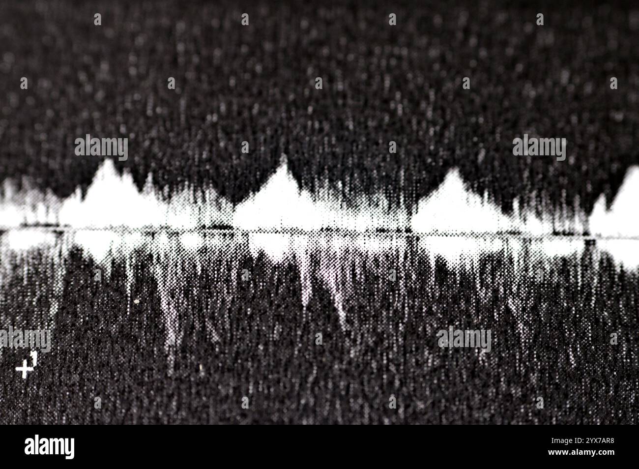 cardiac ultrasound, Echocardiography, a medical imaging using the ...