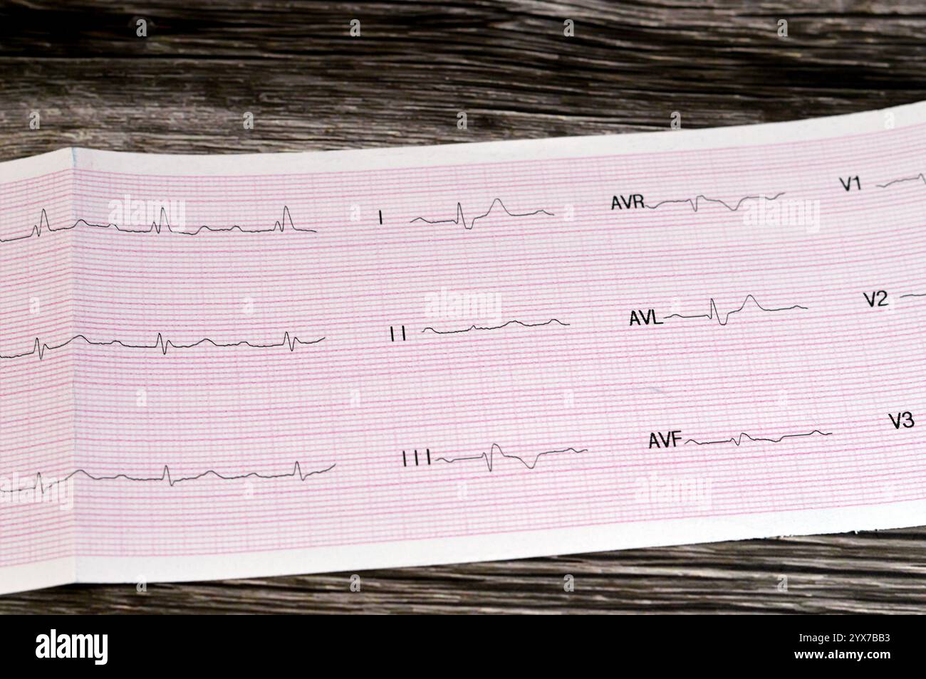 Cairo, Egypt, November 15 2024: ElectroCardioGraph ECG, a chart that ...