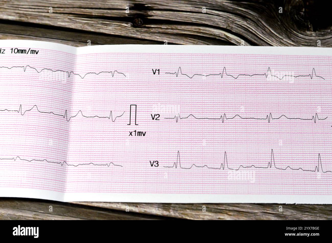 Cairo, Egypt, November 15 2024: ElectroCardioGraph ECG, a chart that ...