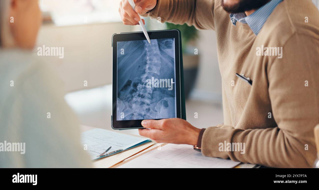 Xray, spine and tablet screen with hands of doctor and old person for ...