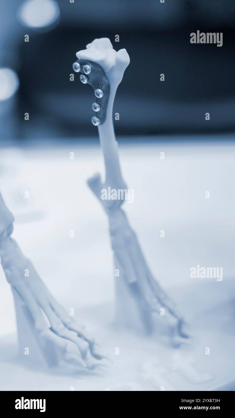 Endoexoprosthetics hi-res stock photography and images - Alamy