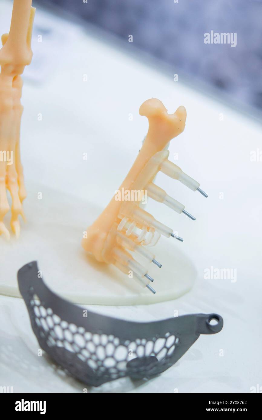 Endoexoprosthetics hi-res stock photography and images - Alamy