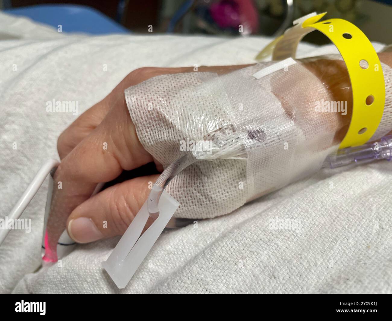 Same day surgery hi-res stock photography and images - Alamy