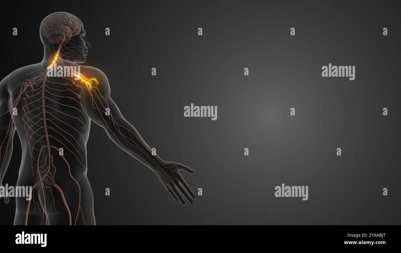 Neck Nerve Compression Leading to Arm Discomfort Stock Photo - Alamy