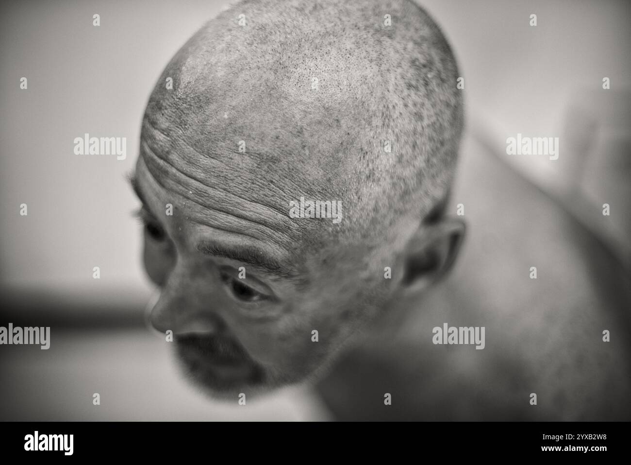 Man with a shaved head and a disturbing gaze, indicating mental ...