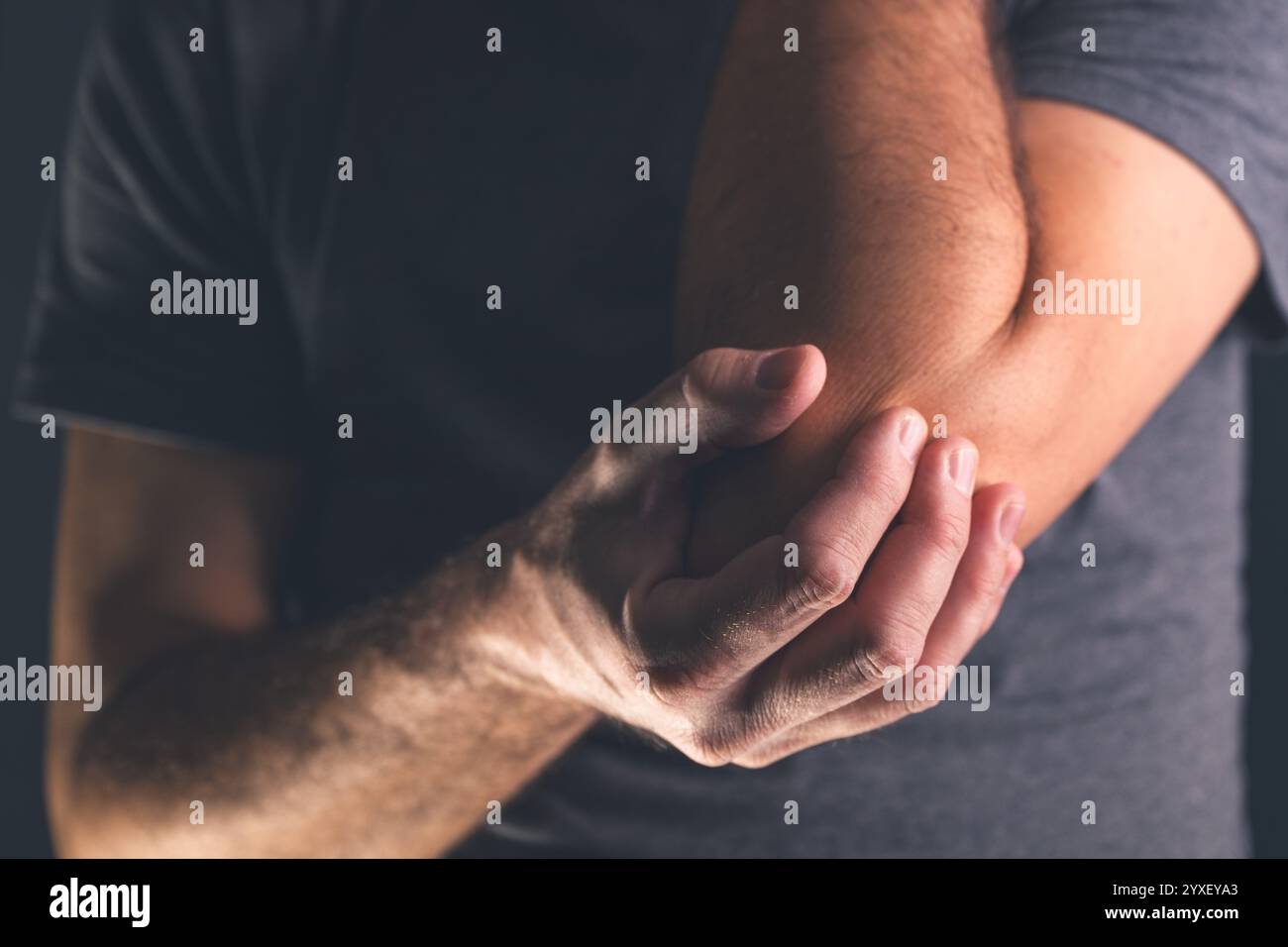 Tennis elbow, clinically known as lateral epicondylitis. is medical ...