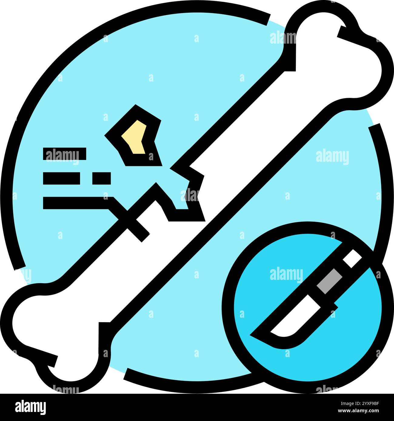 orthopedic surgery fracture injury color icon vector illustration Stock ...